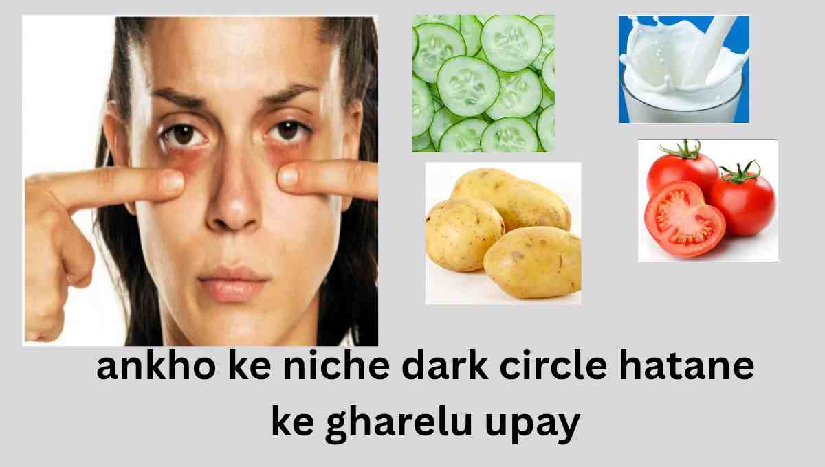 ankho ke niche dark circle hatane ke gharelu upay - rivetbeauty